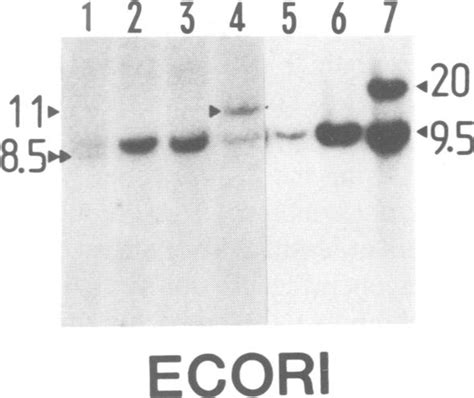 Southern Blots Of Ecorj Digested Tumor Dnas From Patients With Tcell