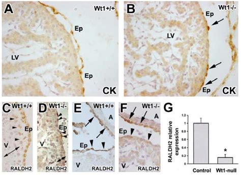 Figure 1 From Wt1 Controls Retinoic Acid Signalling In Embryonic