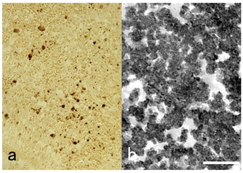 Pre Embedding Immunoelectron Microscopy For Sfts Virus Using A Tacas