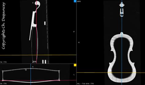 3D StringTheory Project