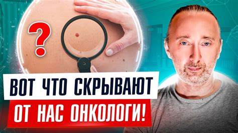 7 причин МЕЛАНОМЫ Особый осмотр защита и лечение от РАКА кожи ЭТО