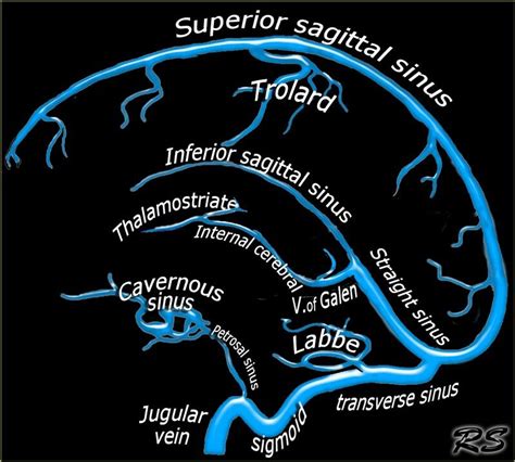 Venous Drainage Of Brain Vein Of Galen Great Cerebral Vein