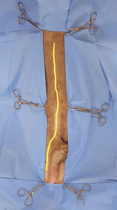 Exploratory Celiotomy General Overview And Guide