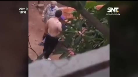 Mujer Fue Víctima De Violencia Por Parte De Su Pareja Snt