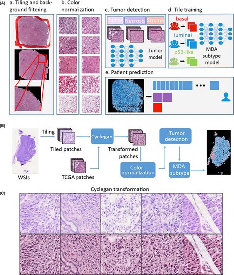preprocessing and deep learning model a a example of a bladder