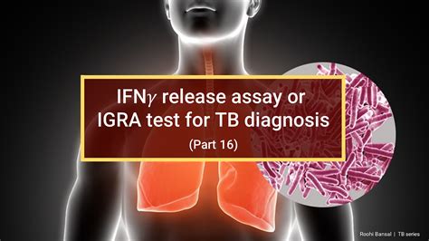 Interferon Gamma Release Assay Or Igra Test For The Diagnosis Of Tb