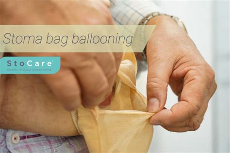 Stoma Blockage Rhodes Pharma