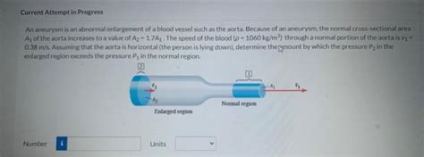 Solved An Aneurysm Is An Abnormal Enlargement Of A Blood Chegg