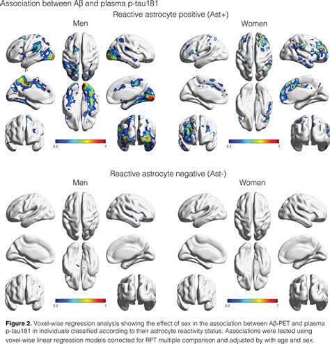Sex Modulates The Role Of Astrocyte Reactivity In Preclinical Alzheimer