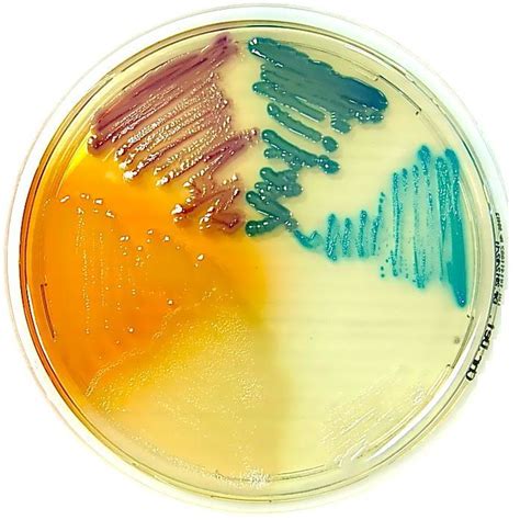 Chromogenic Microbiological Culture Media Suppliers Flickr