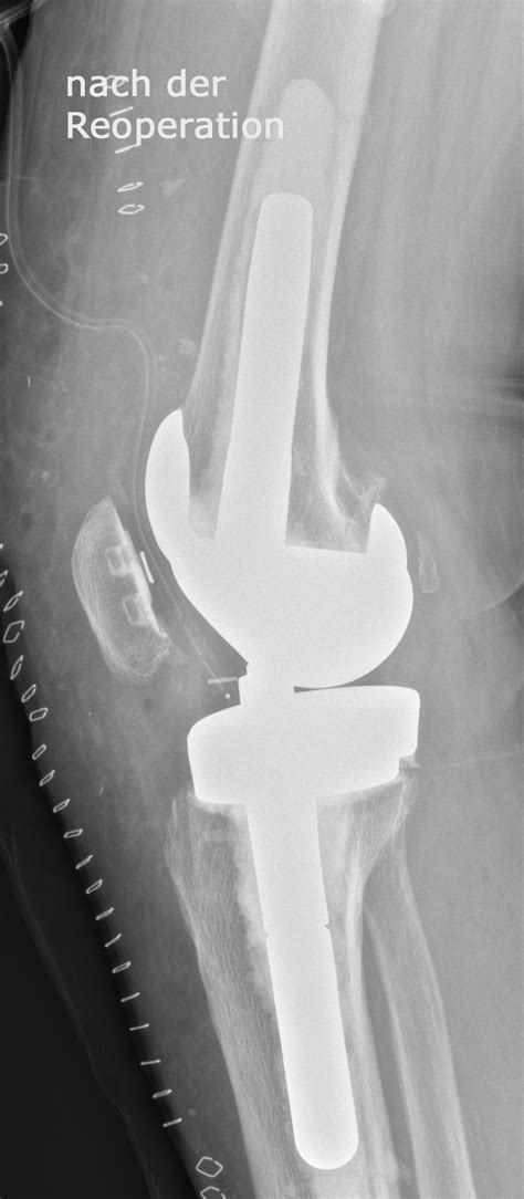 Galerie Univ Doz Dr Max Böhler