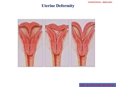 2 2 Congenital Deformities Pdf