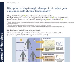 Disruption Of Day To Night Changes In Circadian Gene Expression With