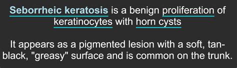 ultimate gpt 4 prompt for perfect lecture flashcards r medicalschoolanki