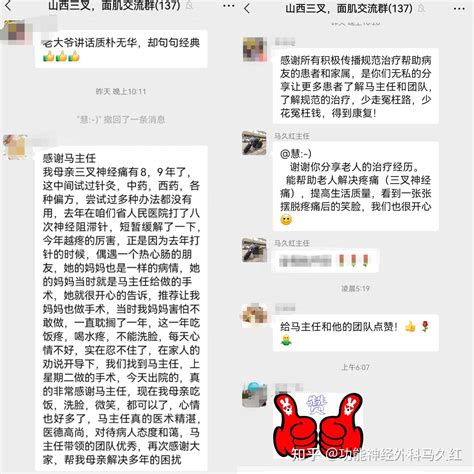 【病例 三叉神经痛】吃饭疼、喝水疼、洗脸疼、笑一下都疼，mvd手术终于解除10年顽痛 知乎