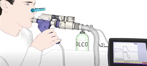 Dlco Respiratory Testing Ioh