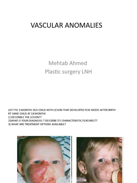 Classification Diagnosis And Management Of Vascular Anomalies In