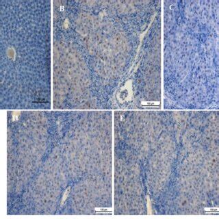 Immunostaining Analysis Of Liver Tissue Sections A Normal Group B