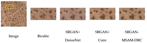 A Super Resolution Reconstruction Model For Remote Sensing Image Based On Generative Adversarial