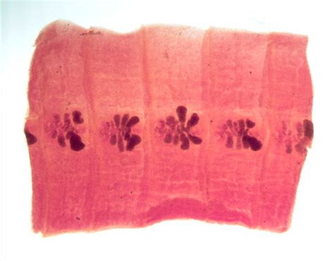 Clinical Microbiology Helmiths Flatworm Cestodes Flashcards Quizlet