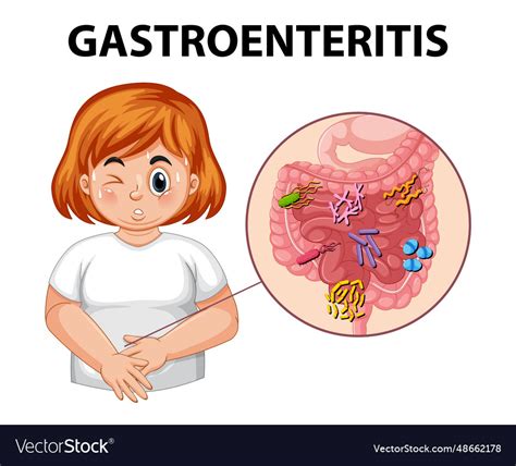 Chubby Woman With Gastroenteritis Symptoms Vector Image