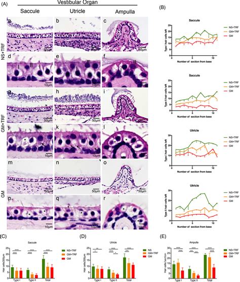 Histopathology And Numerical Evaluation Of Vestibular Endorgan A He