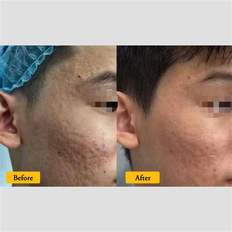 About Us Page About Us Top Beauty Laser Clinic