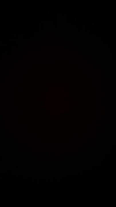 계속 구라만 정신병걸려서 늙어서 기억없이 살았다면 어떻게하시겠습니까 Youtube