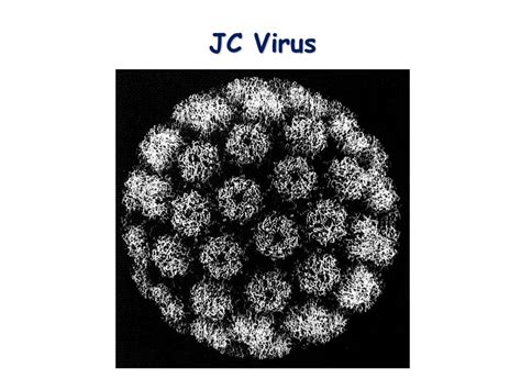 Multiple Sclerosis Research Modeling Jcv Virus Infection