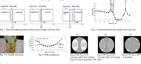 Figure 3 From Self Decoupled Asymmetric Saddle Coil Array For Sense