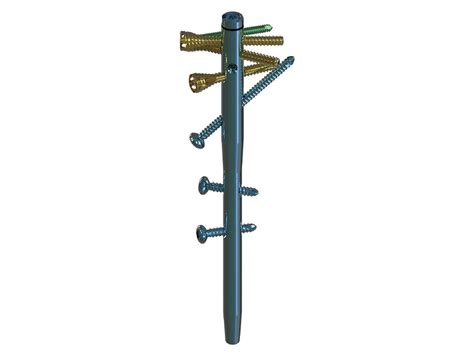 Lepu Medical Humeral Interlocking Nail Manufacturer