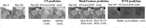 Figure 1 From Spatio Temporal Convolutional Lstms For Tumor Growth
