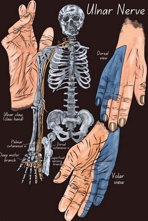Ulnar Nerve Ulnar Nerve Compression In Guyons Canal Advanced