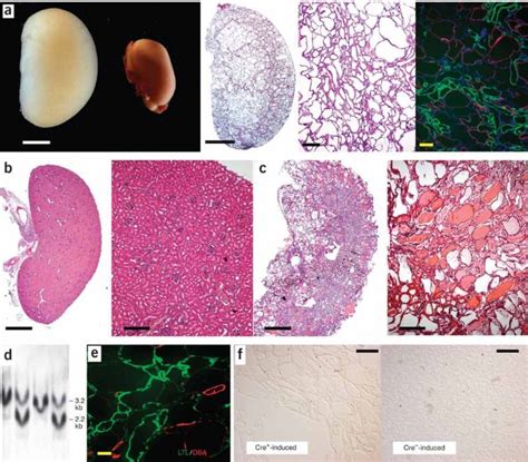 A Critical Developmental Switch Defines The Kinetics Of Kidney Cyst