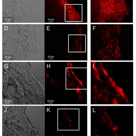 Analysis Of Inflammatory Cytokines Detected In The Ex Vivo Mrsa