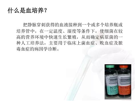 Ppt