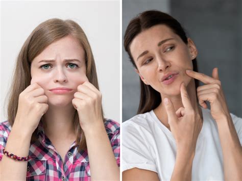 Facial Exercise For Chubby Cheeks Know How To Remove Facial Fat And Get