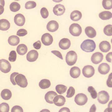 CML Slide CellWiki