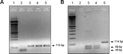 Flt3 D835 Genotyping A Pcr Amplification Of Flt3 Lane 1 100 Bp
