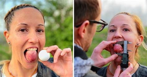 “골프공보다 굵어”… 세계서 가장 두꺼운 혀 가진 여성