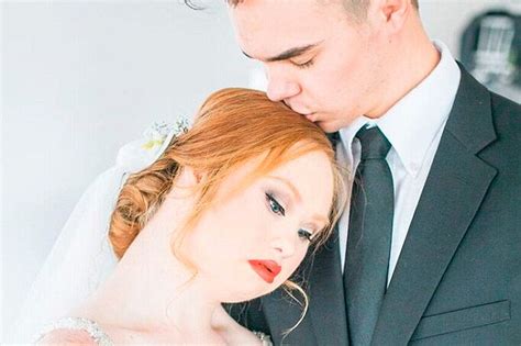 Международный день людей с синдромом Дауна Доктор Елена Березовская