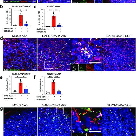 Sars Cov 2 Impact On Different Brain Cell Types A D G Immunolabeling