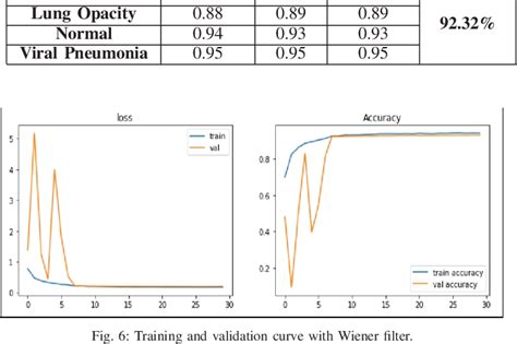 Figure 1 From Analysis Of Pneumonia Detection In X Ray Images Using