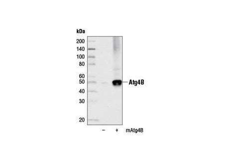 Autophagy Vesicle Elongation Lc3 Conjugation Antibody Sampler Kit