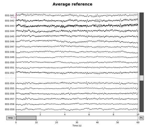Setting The Eeg Reference — Mne 151 Documentation
