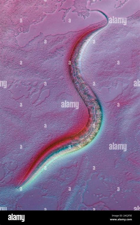C Elegans Worm Differential Interference Contrast Micrograph Of A