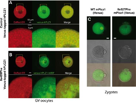 Figure 1 From Homozygous Mutation Of Plcz1 Leads To Defective Human