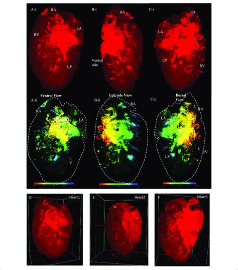 3d Volume Reconstruction Of The Spatial Distribution Of Pnmt