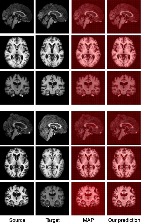 Figure 1 From Deep Learning For Regularization Prediction In Diffeomorphic Image Registration