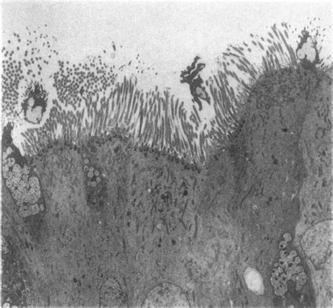 Electron Micrograph Of Trachea 30 S After Exposure To 10 Ug P